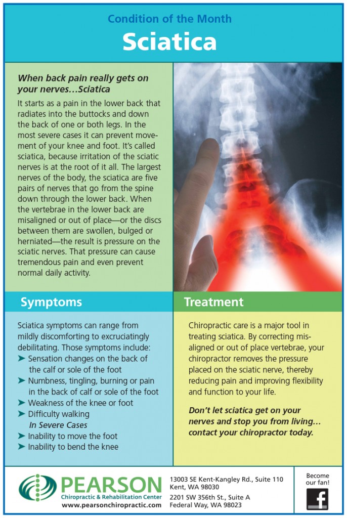 Sciatica - Pearson Chiropractic & Rehabilitation